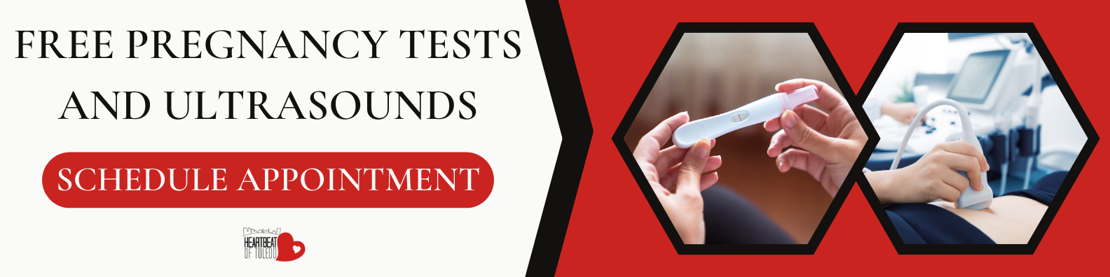 Pregnancy Ultrasound Scans Explained | Heartbeat of Toledo